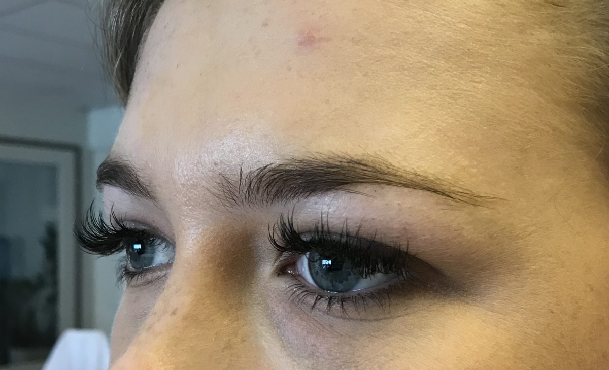 voor - Esthetiek Nijmegen